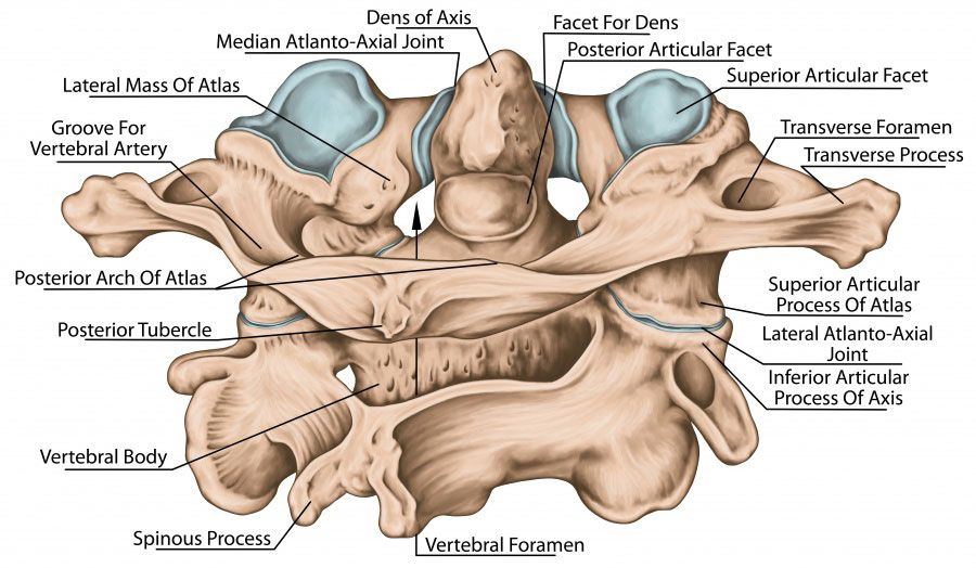 Cervical Fracture - Colorado Springs Orthopedic News
