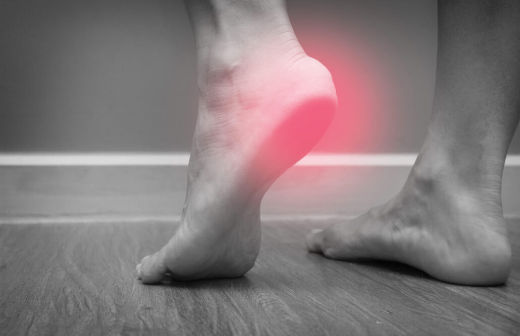 Plantar Fasciitis Prevention and Treatment - Colorado Springs ...