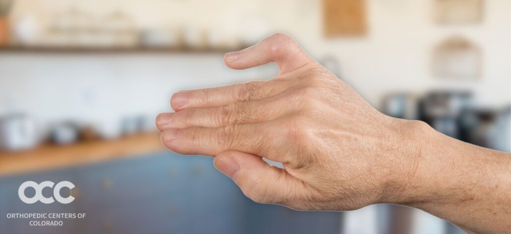 Boutonnière Deformity - Colorado Springs Orthopedic News