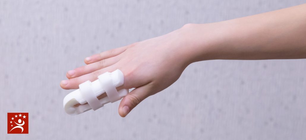 Finger Fracture - Colorado Springs Orthopedic News